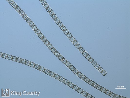 SoundToxins — Phytoplankton of the Month Archive