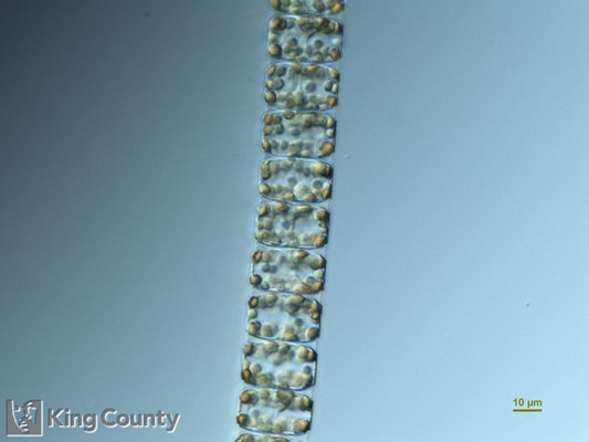 SoundToxins — Phytoplankton of the Month Archive