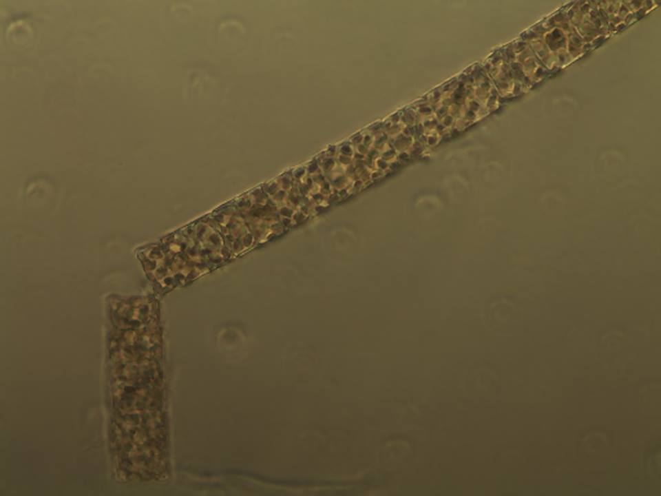 SoundToxins — Phytoplankton of the Month Archive
